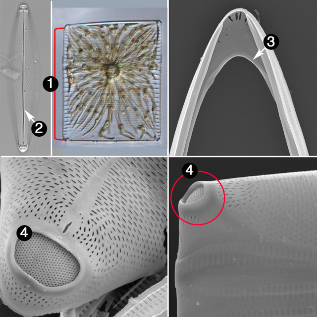 Striatella | Genera - Diatoms of North America
