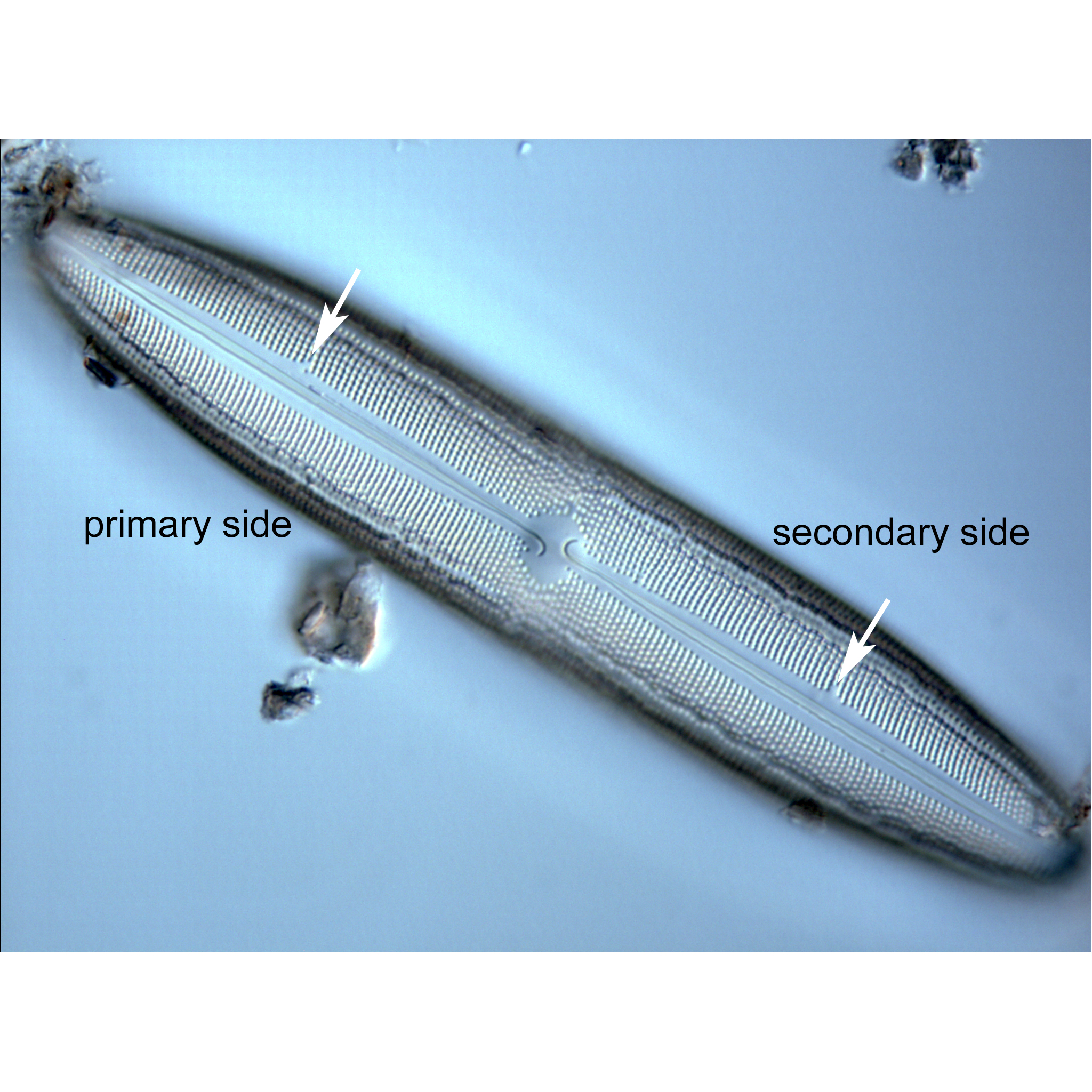 Primary side | Glossary - Diatoms of North America