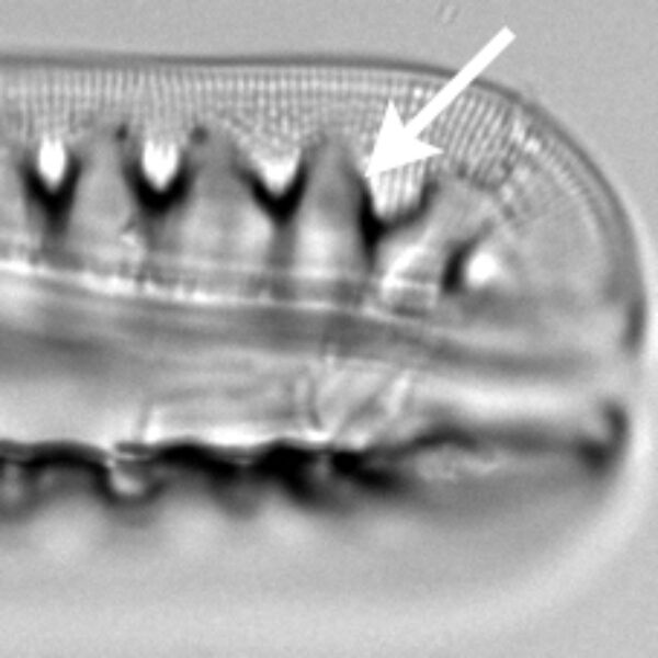 Junction line | Glossary - Diatoms of North America