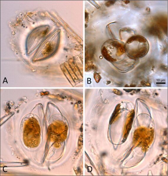Reproduction (sexual) | Glossary - Diatoms of North America