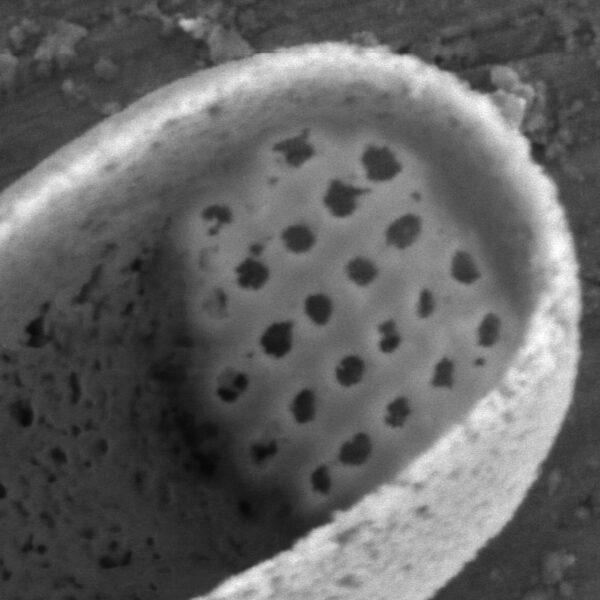 Ocellulimbus | Glossary - Diatoms of North America