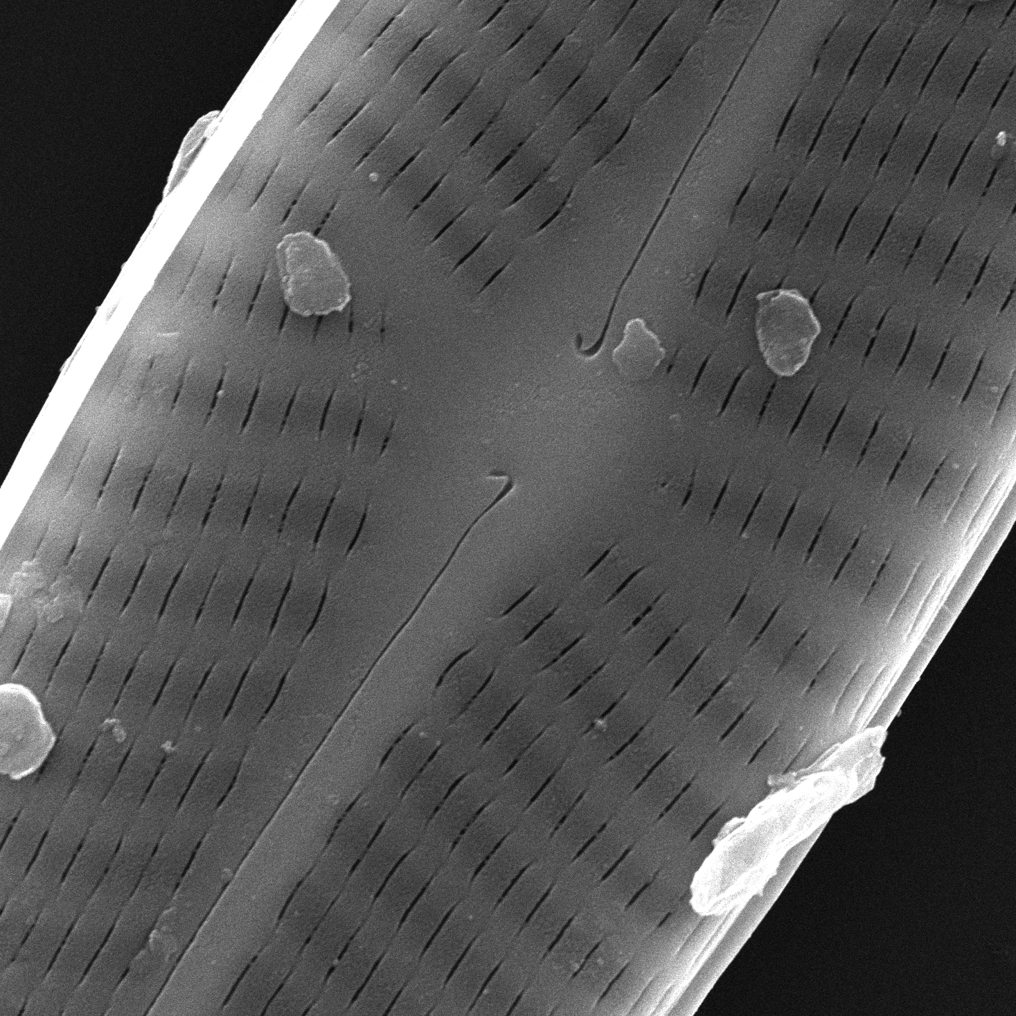 Lineola | Glossary - Diatoms of North America