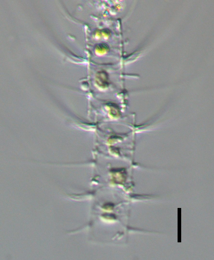 Image Chaetoceros_constrictus-LM3.jpg | Species - Diatoms of North America