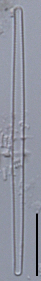 Image Fragilaria-aquaplus-LM3_2025-05-28-192203_ujlg.jpg | Species ...