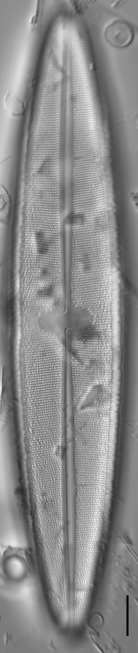 Image Neidium_rugosum_1_NPS-13387b.jpg | Species - Diatoms of North America